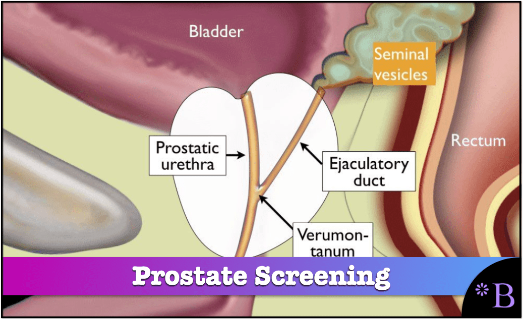 Does Prostate Screening Improve Patient Outcomes? - Brightwork Research ...